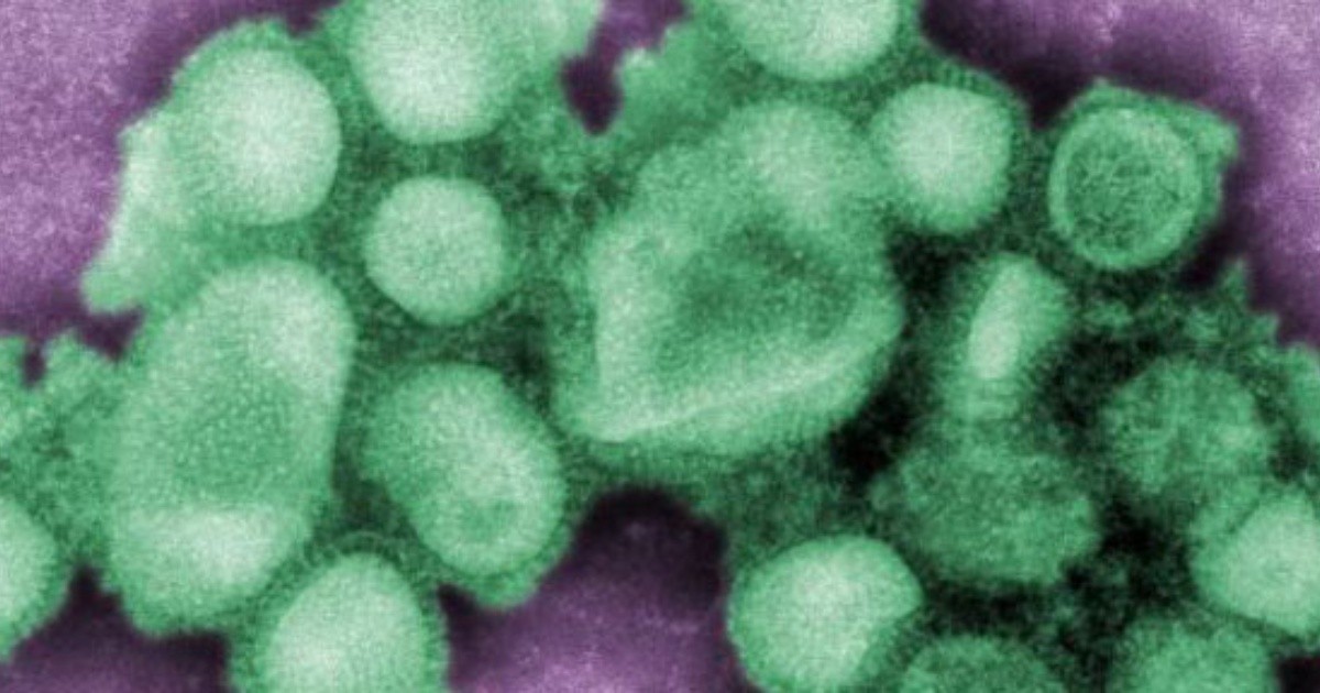 Cara a cara con el virus de la gripe N1H1 | Rosario3