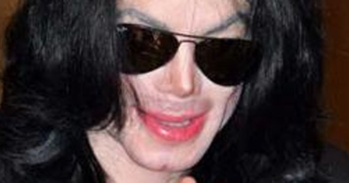 ¿Dónde está la nariz de Michael Jackson? | Rosario3