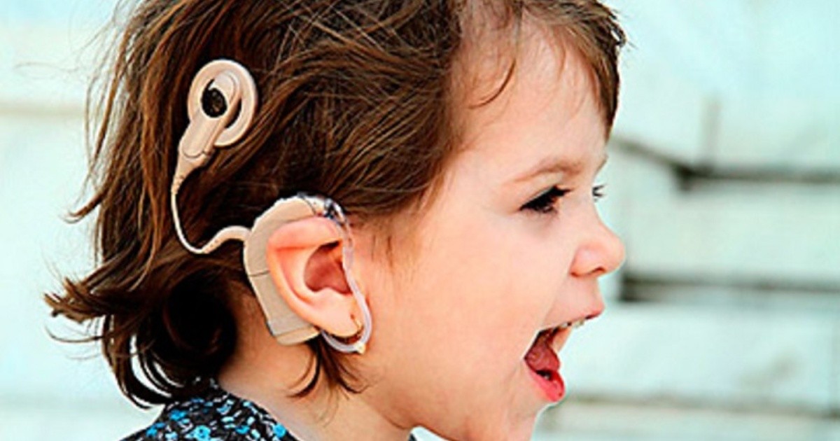 La importancia del implante coclear | Rosario3