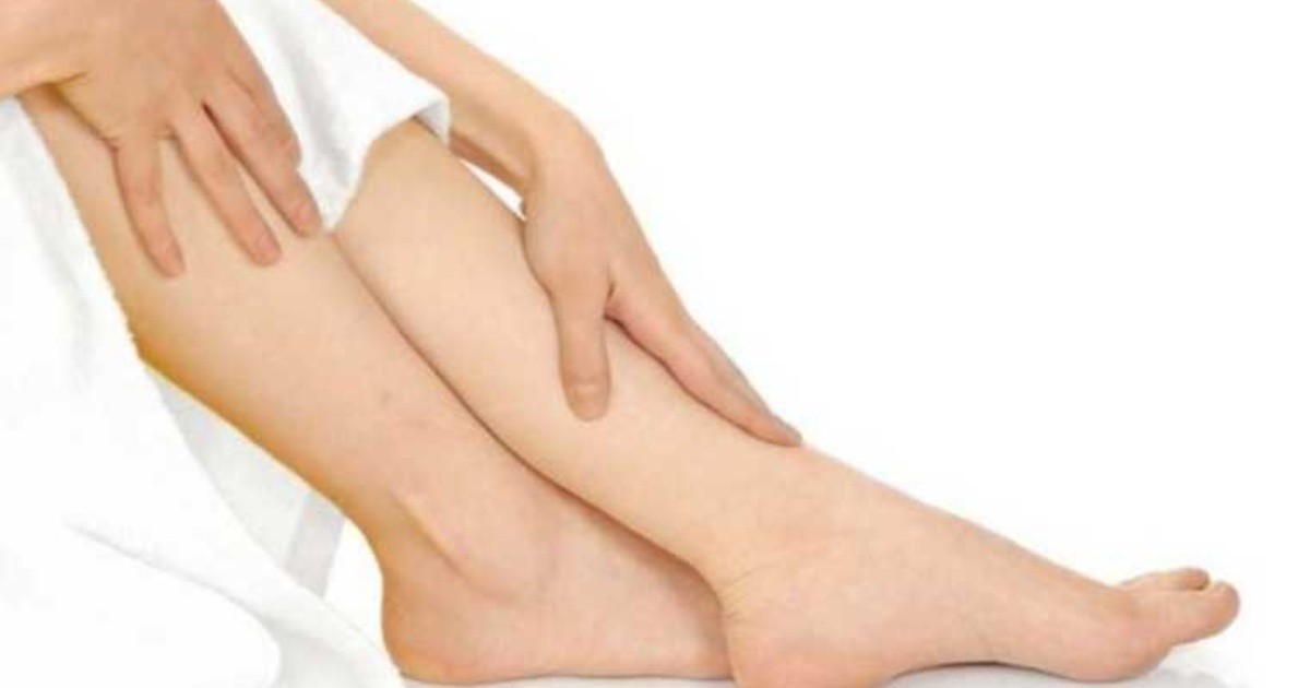 6 curiosidades sobre las venas varicosas | Rosario3