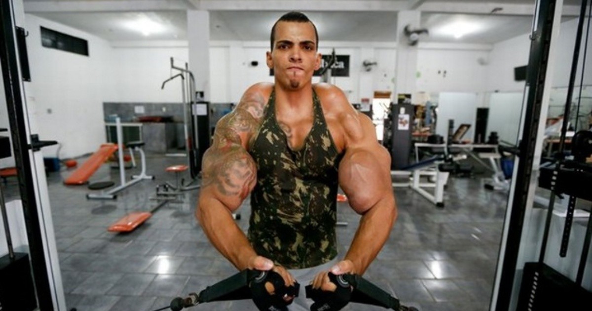 Hulk brasileño: se desinfló para evitar amputaciones y así quedó | Rosario3