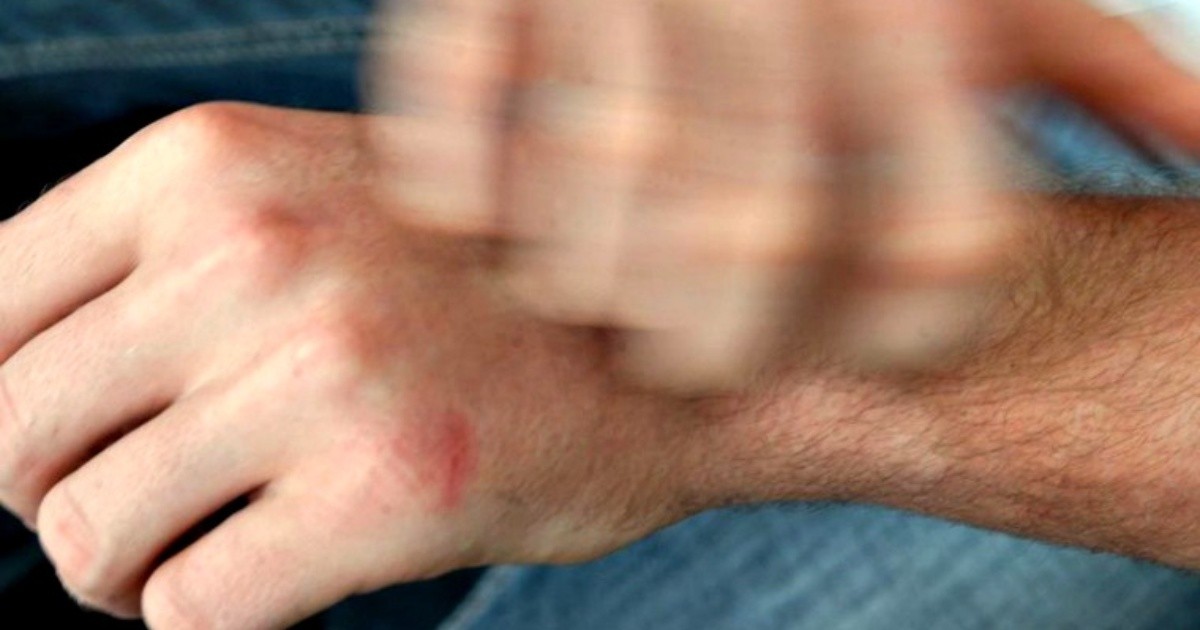 ¿Por qué rascarse una sola vez no alcanza? | Rosario3