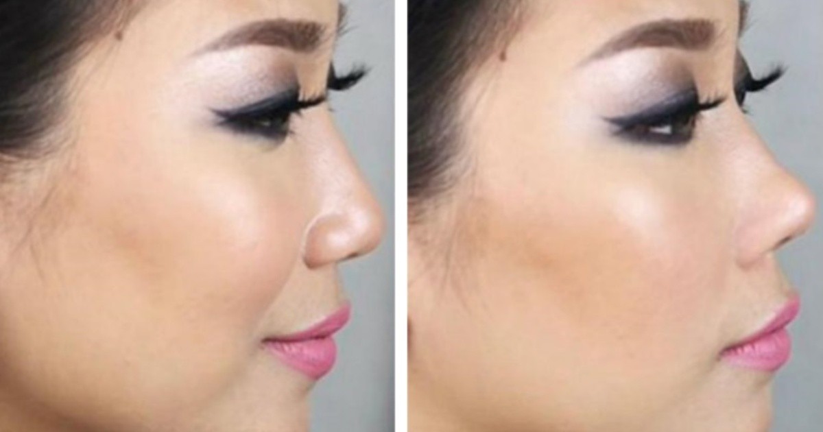 Nariz respingada en 30 segundos | Rosario3