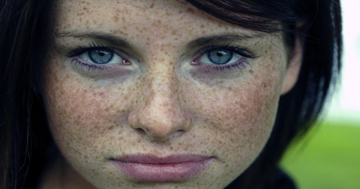 La nueva moda de tatuarse pecas en la cara | Rosario3