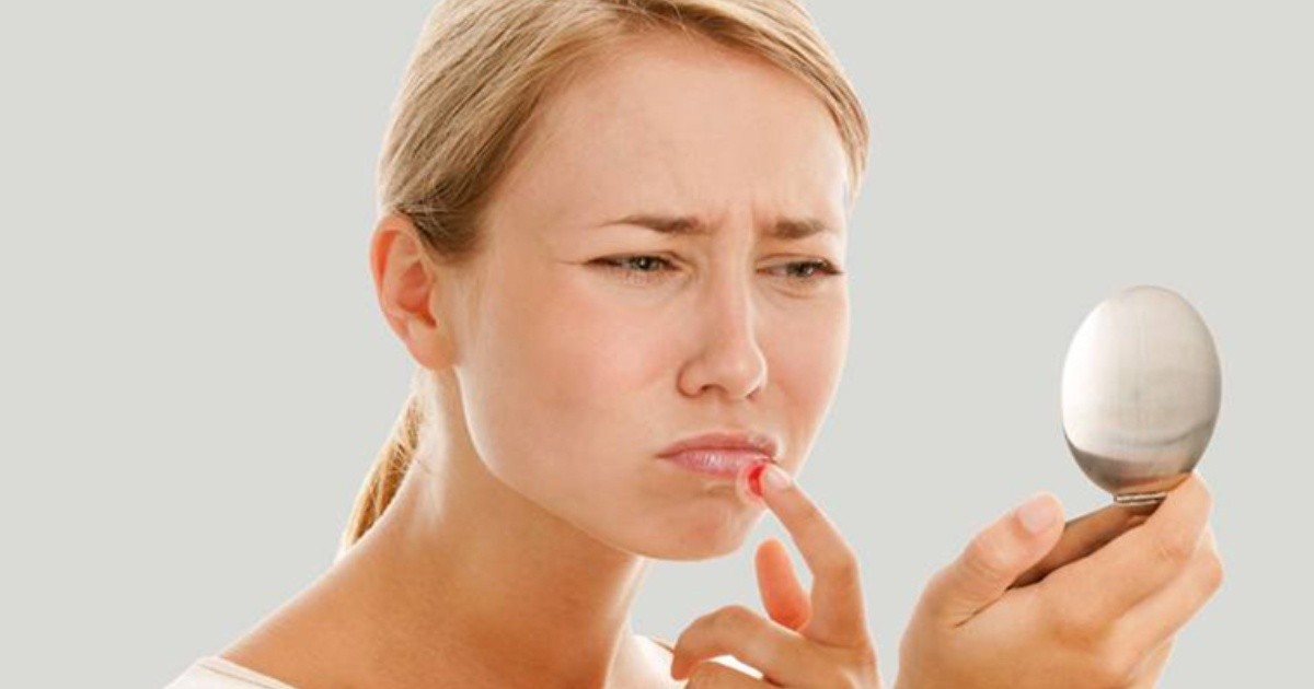 Los peligros de reventarse un grano | Rosario3