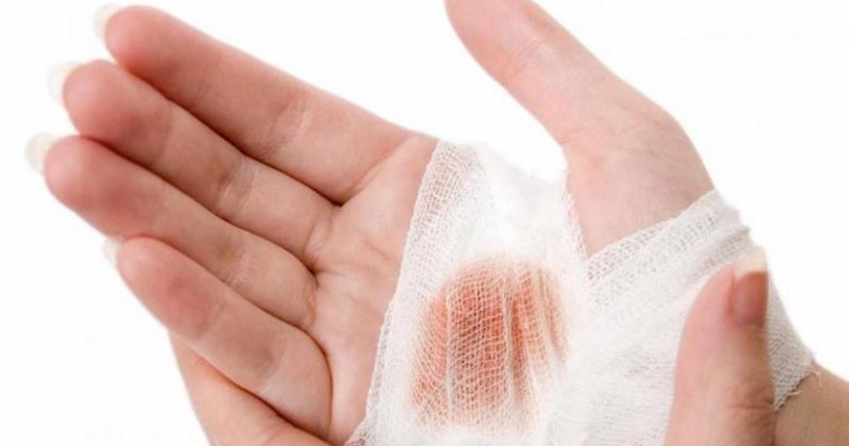 Cómo tratar una herida infectada | Rosario3