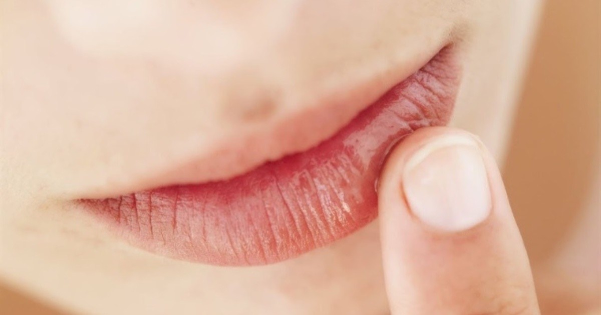 ¿Qué son las Manchas de Fordyce? | Rosario3