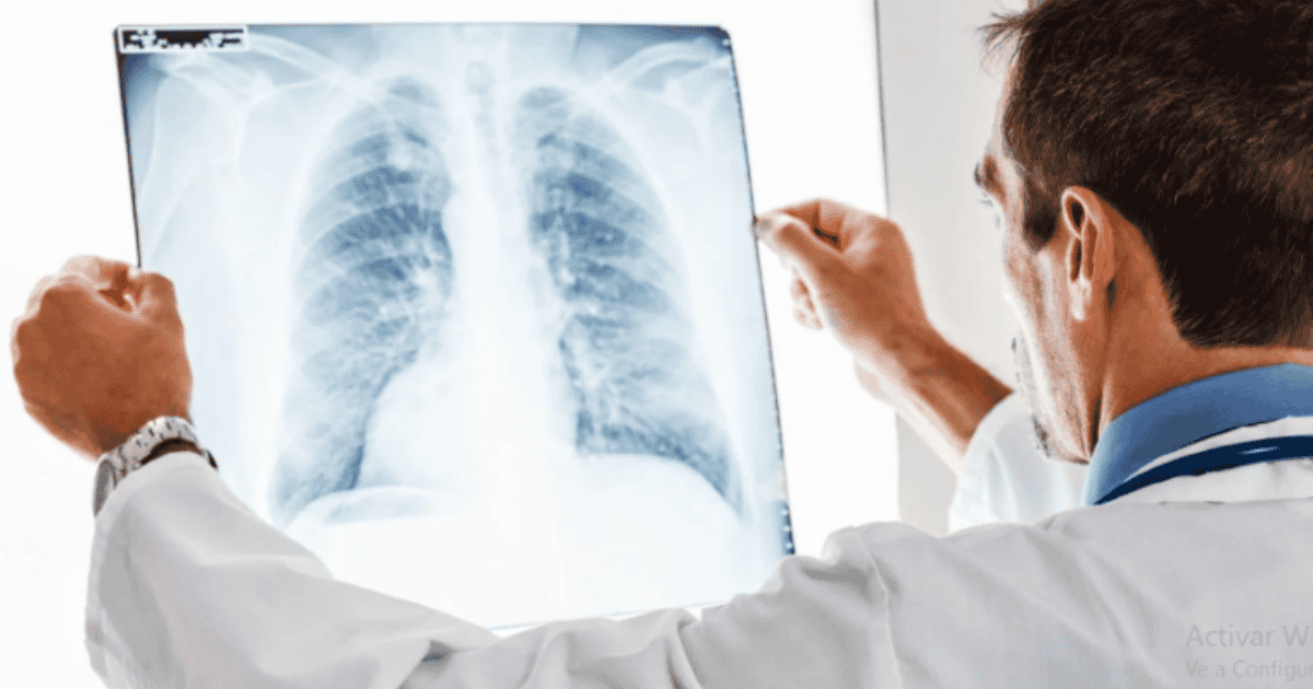 ¿Qué es un Nódulo pulmonar? | Rosario3