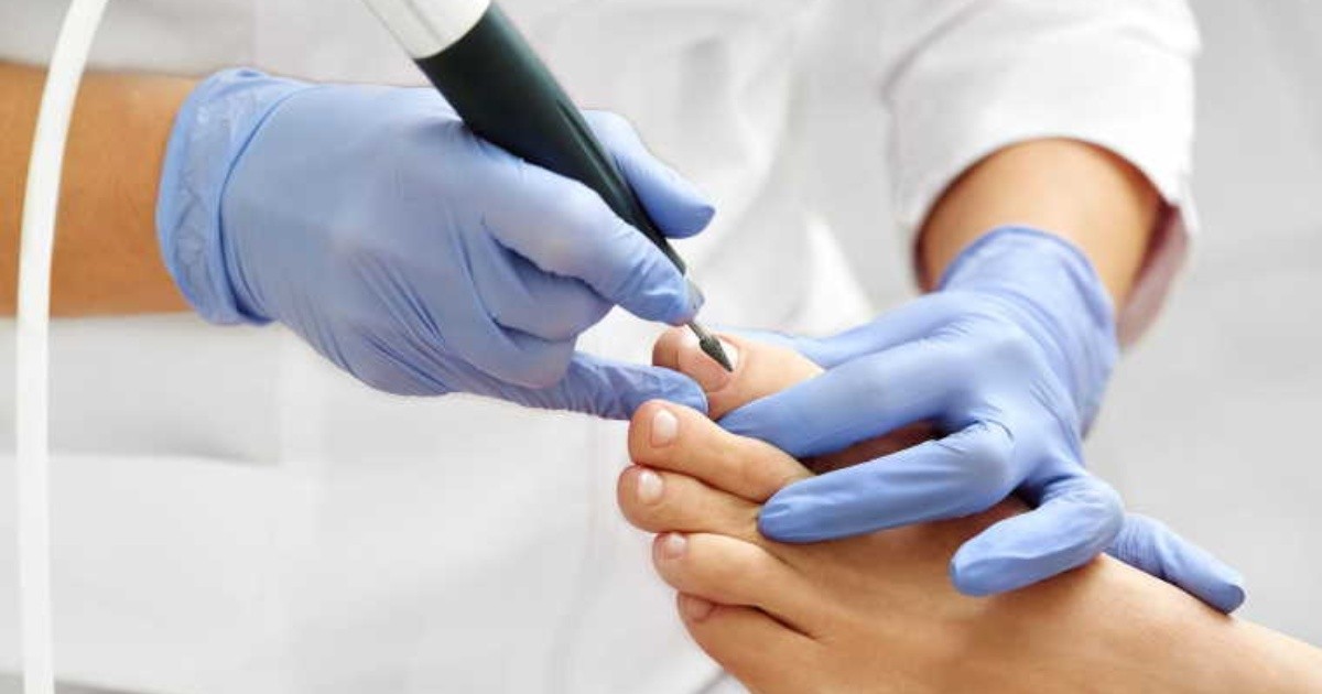 ¿El podólogo debe integrar el equipo de salud? | Rosario3