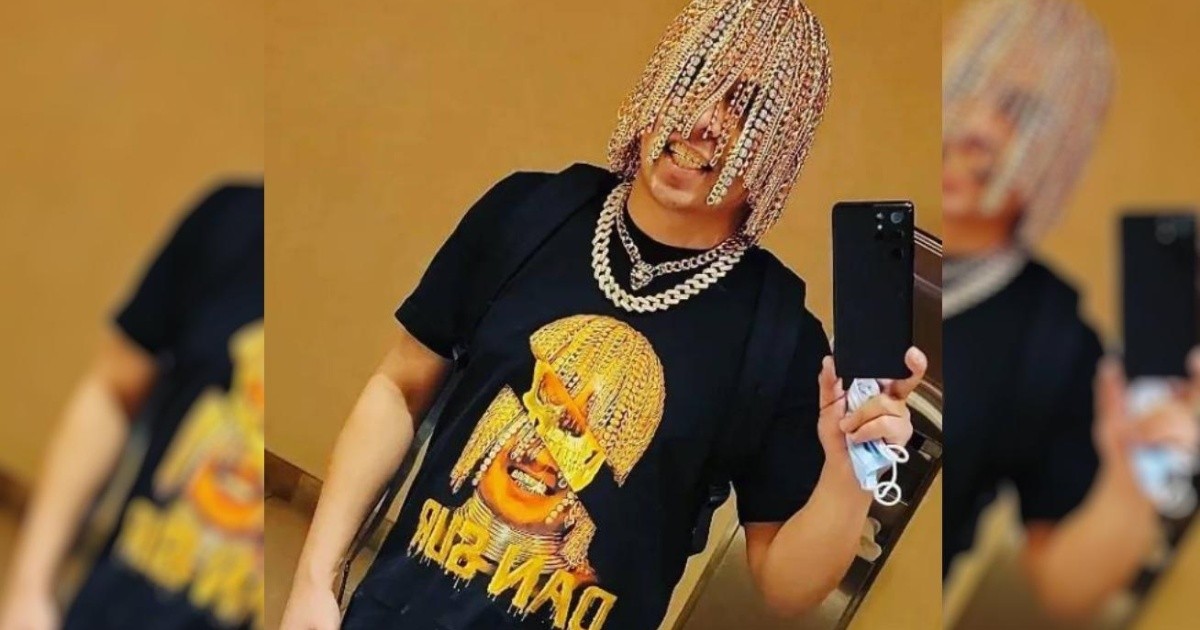 Dan Sur, el rapero que se implantó cadenas de oro en la cabeza | Rosario3