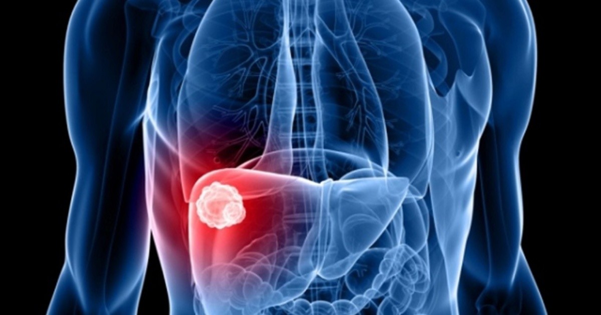 Comprueban acción de una proteína capaz de revertir el desarrollo de ...