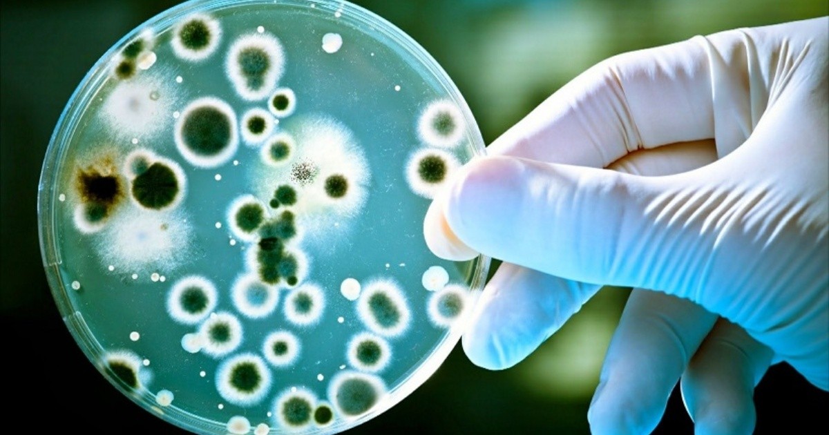 Las infecciones por bacterias multirresistentes causan más muertes que ...