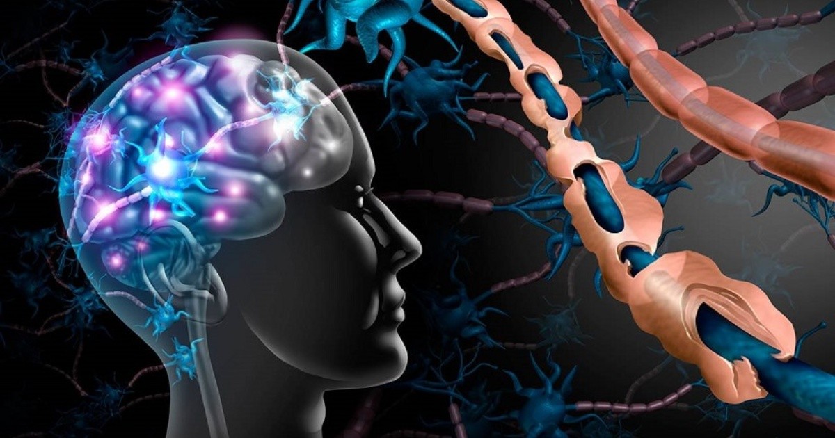 Esclerosis múltiple: nuevas recomendaciones de especialistas | Rosario3