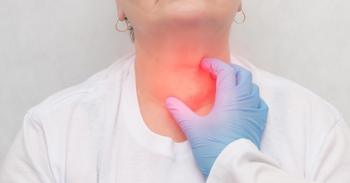 El cáncer de cabeza y cuello presenta factores de riesgo "prevenibles ...