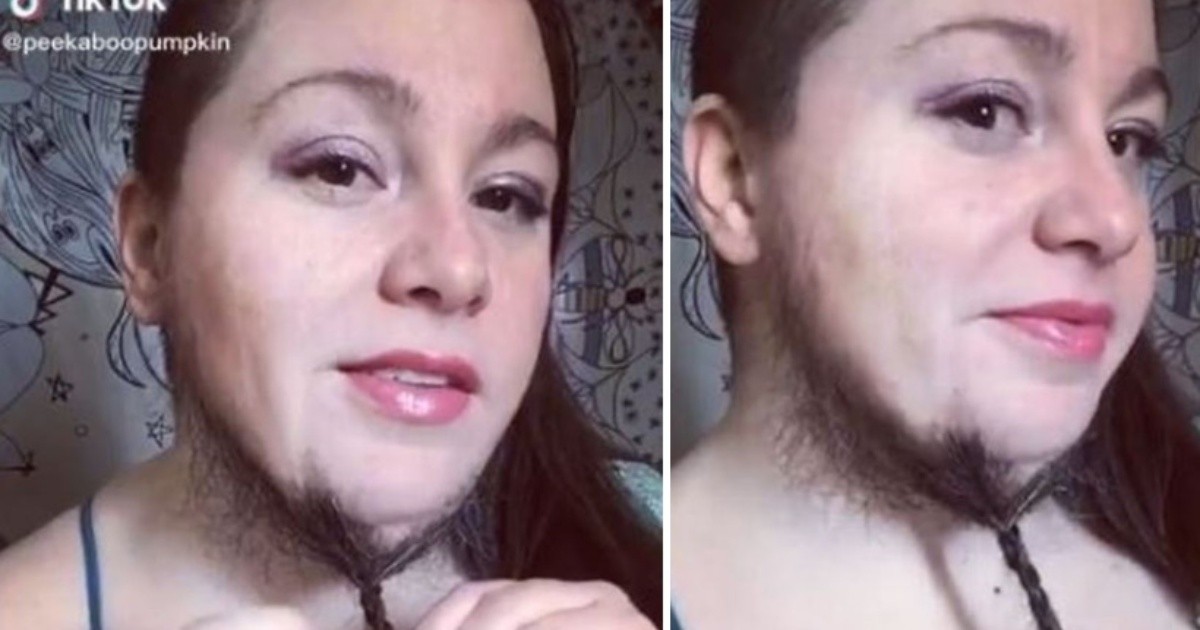 Se cansó del vello facial, lo dejó crecer y se volvió estrella de Tik Tok | Rosario3