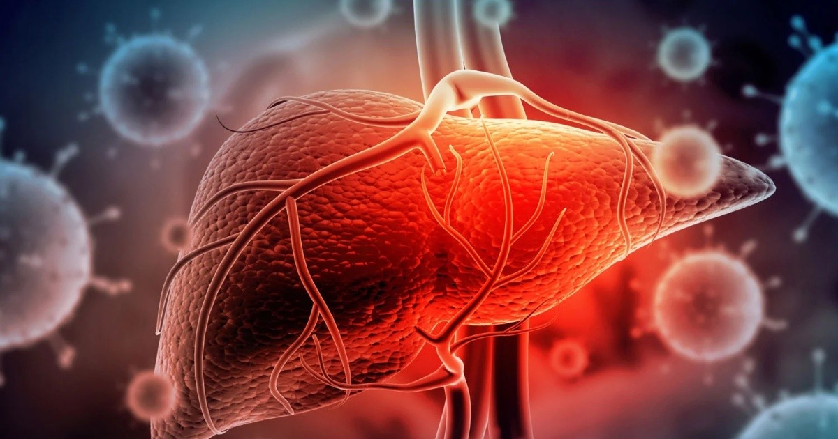 "Una vida, un hígado": Día Mundial contra la Hepatitis | Rosario3