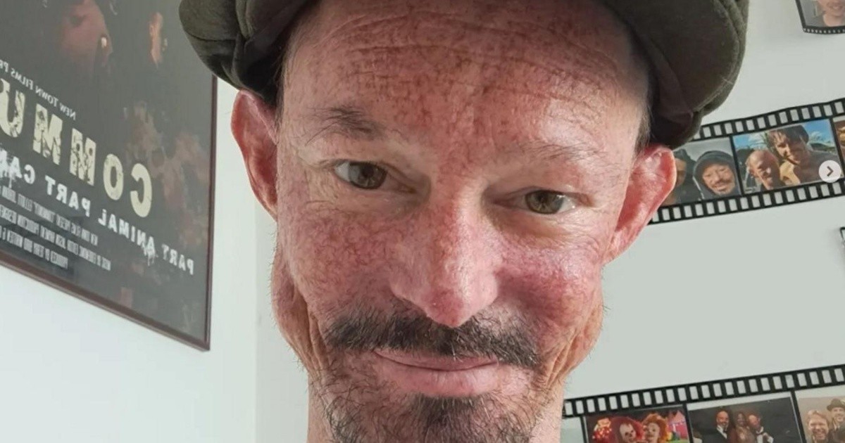 Murió a los 36 años Darren Kent, actor de Games of Thrones | Rosario3