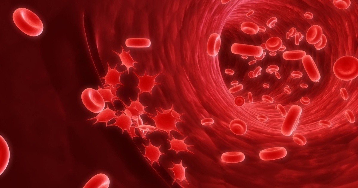 Qué es la HPN, una patología poco frecuente | Rosario3