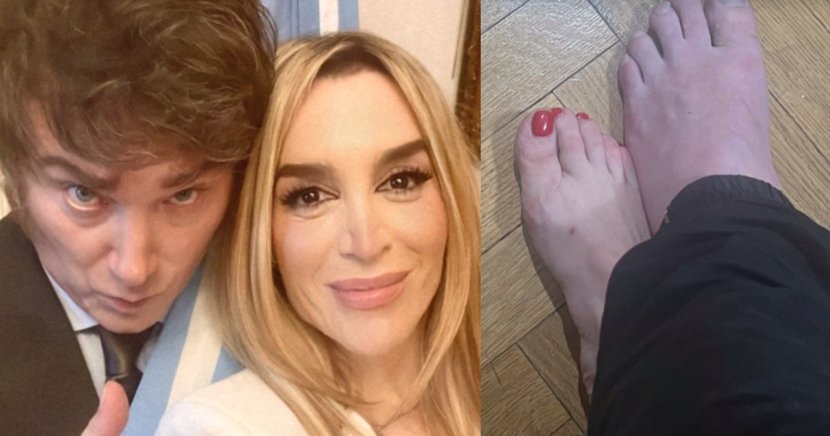 La publicación de Fátima Florez ¿y el pie de Javier Milei? | Rosario3
