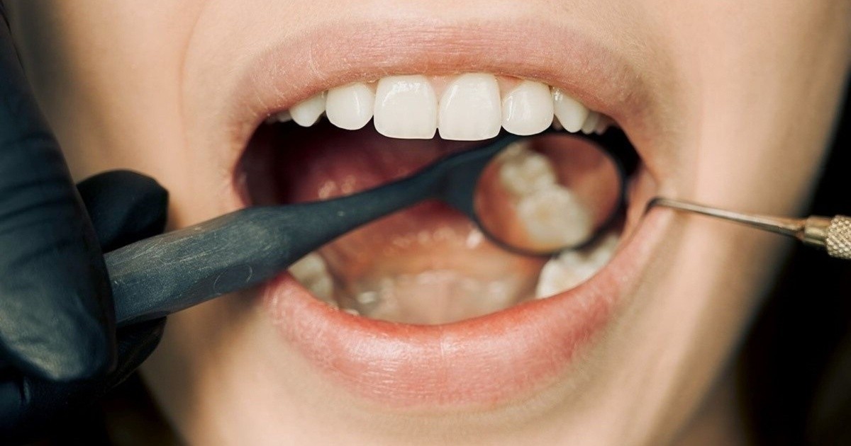 Consejos para una boca sana y cuidada | Rosario3