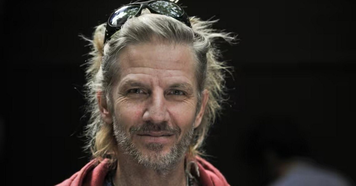 El emotivo posteo de Facundo Arana sobre la aparición de carcinomas en su piel: "La mejor forma ...