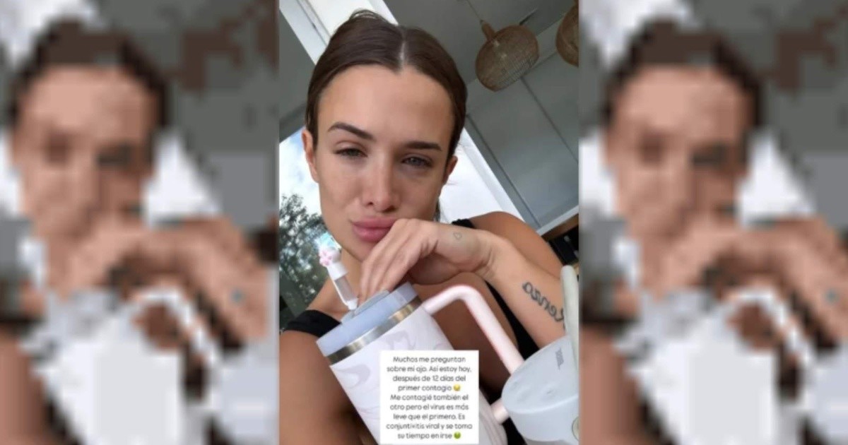 Cami Homs mostró cómo tiene los ojos tras 12 días con conjuntivitis ...