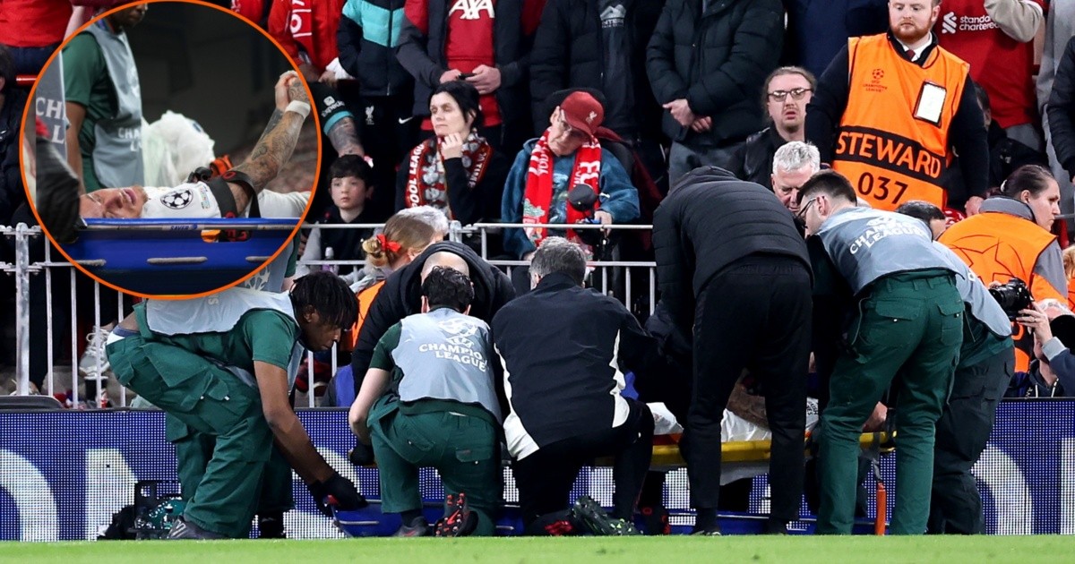 Un jugador del Galatasaray sufrió la amputación parcial de un dedo en ...